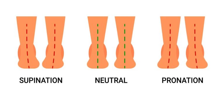 Supination: Eine präzise Definition und Lösungen - LaufSchuhWelt