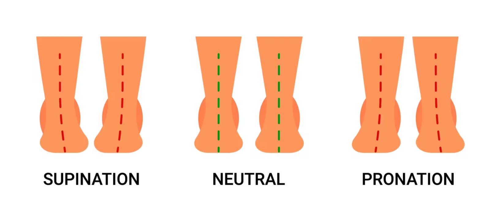 Supination: Eine präzise Definition und Lösungen - LaufSchuhWelt